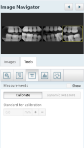 Integration and Streamlined Imaging with the Dentrix Imaging Center ...