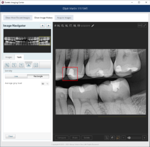 Integration and Streamlined Imaging with the Dentrix Imaging Center ...