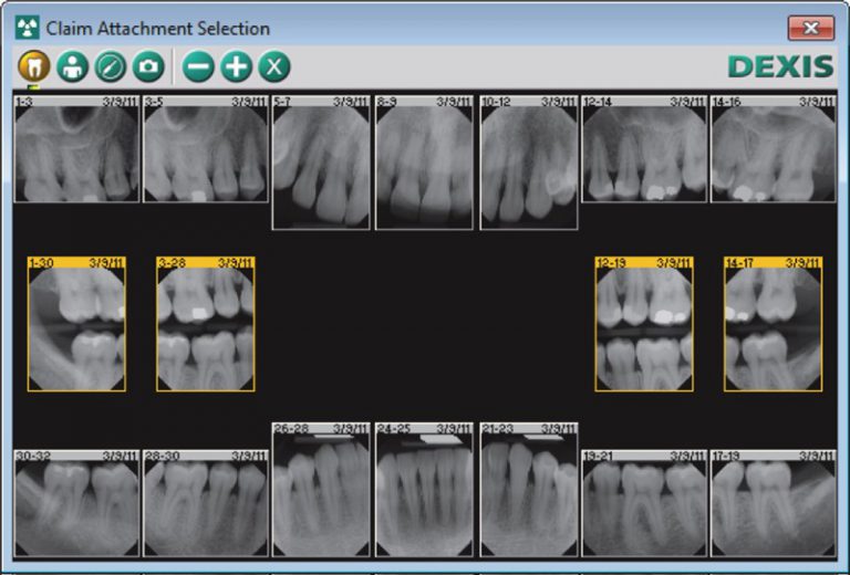 DEXIS and Dentrix: Seamless Integration Redefined – Dentrix Magazine