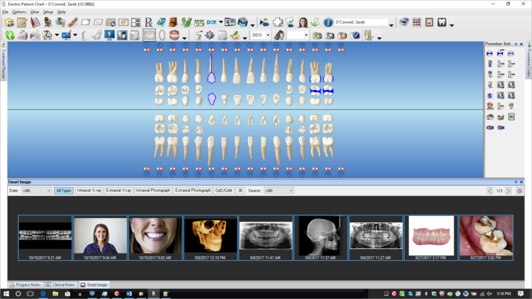 Reinvent Your Dental Imaging Process with Dentrix Smart Image – Dentrix ...