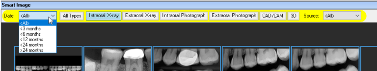 Reinvent Your Dental Imaging Process with Dentrix Smart Image – Dentrix ...