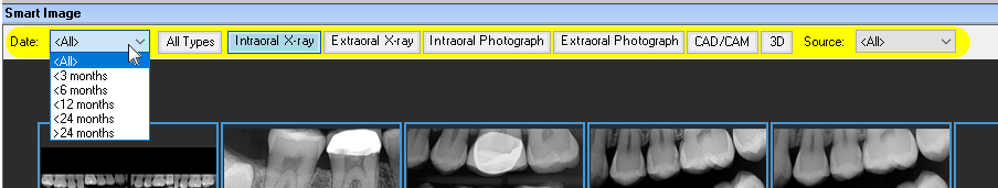 Reinvent Your Dental Imaging Process with Dentrix Smart Image – Dentrix ...