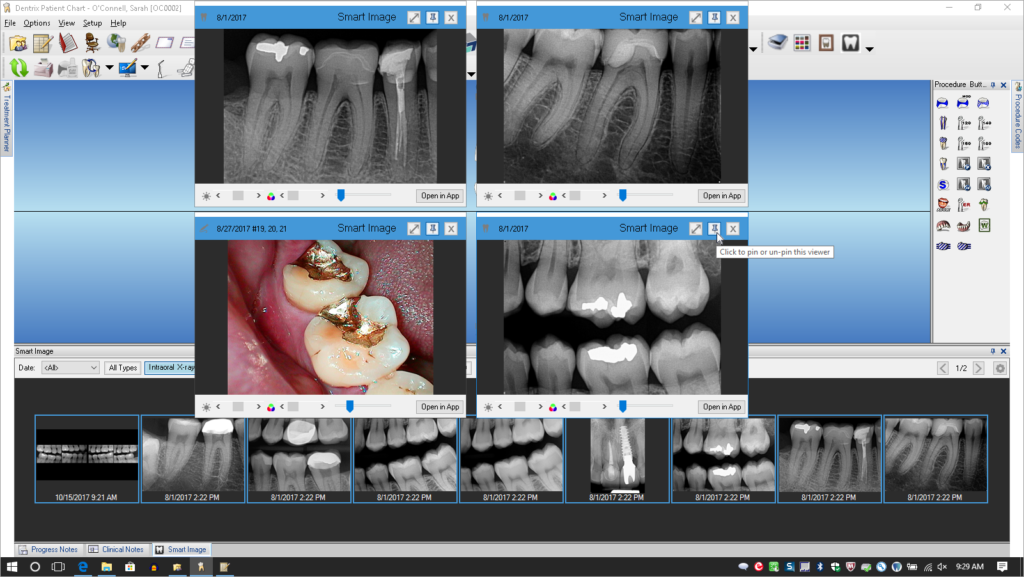 Reinvent Your Dental Imaging Process with Dentrix Smart Image – Dentrix ...