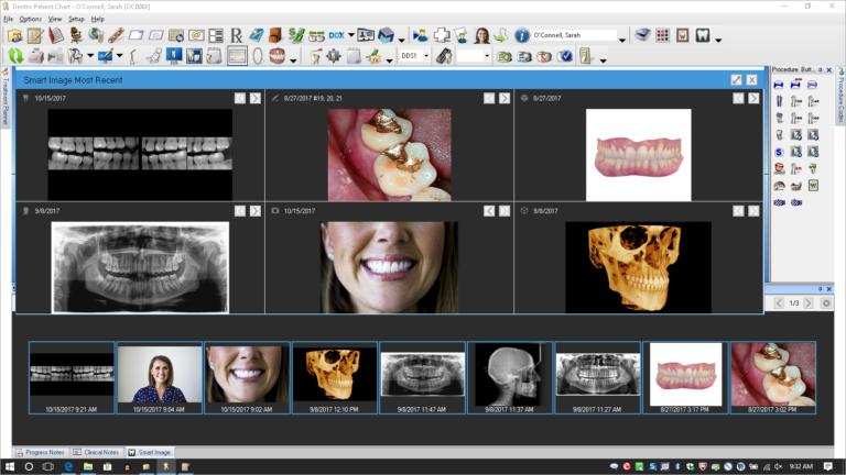 Reinvent Your Dental Imaging Process with Dentrix Smart Image – Dentrix ...
