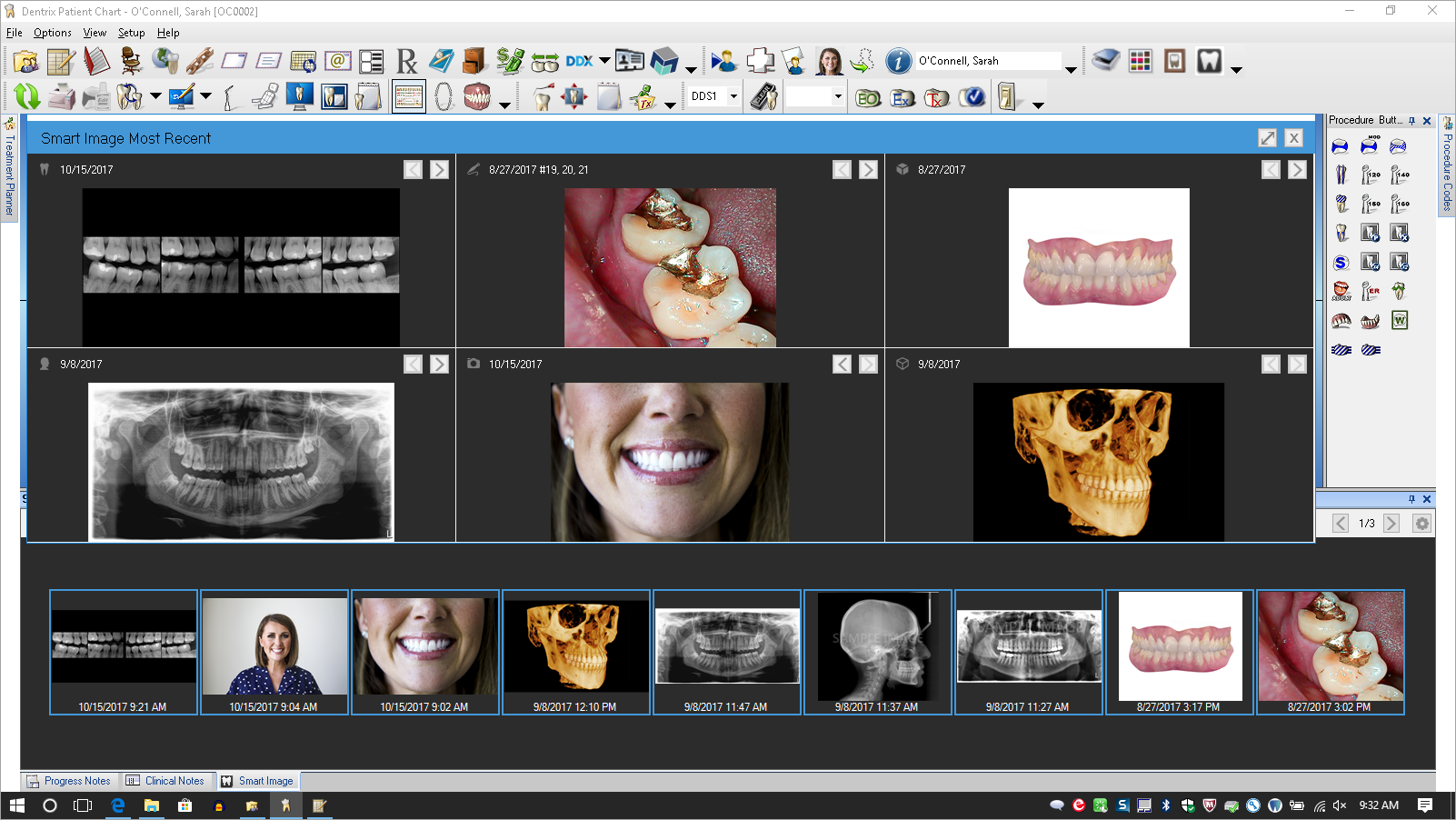 Reinvent Your Dental Imaging Process with Dentrix Smart Image – Dentrix ...