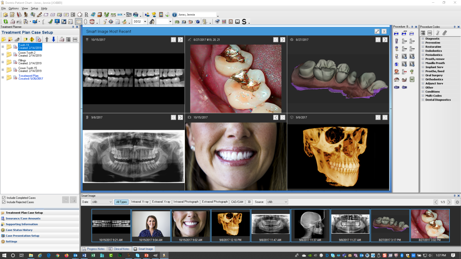 Henry Schein One Announces Dentrix Smart Image 2.0 – Dentrix Magazine