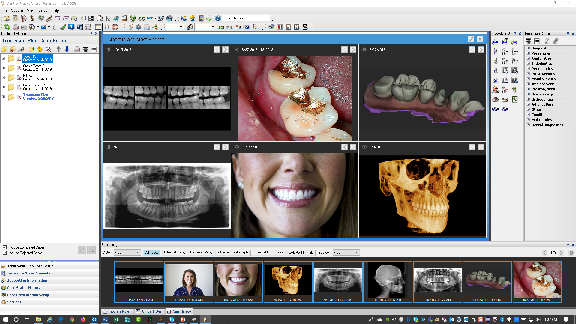 Henry Schein One Announces Dentrix Smart Image 2.0 – Dentrix Magazine
